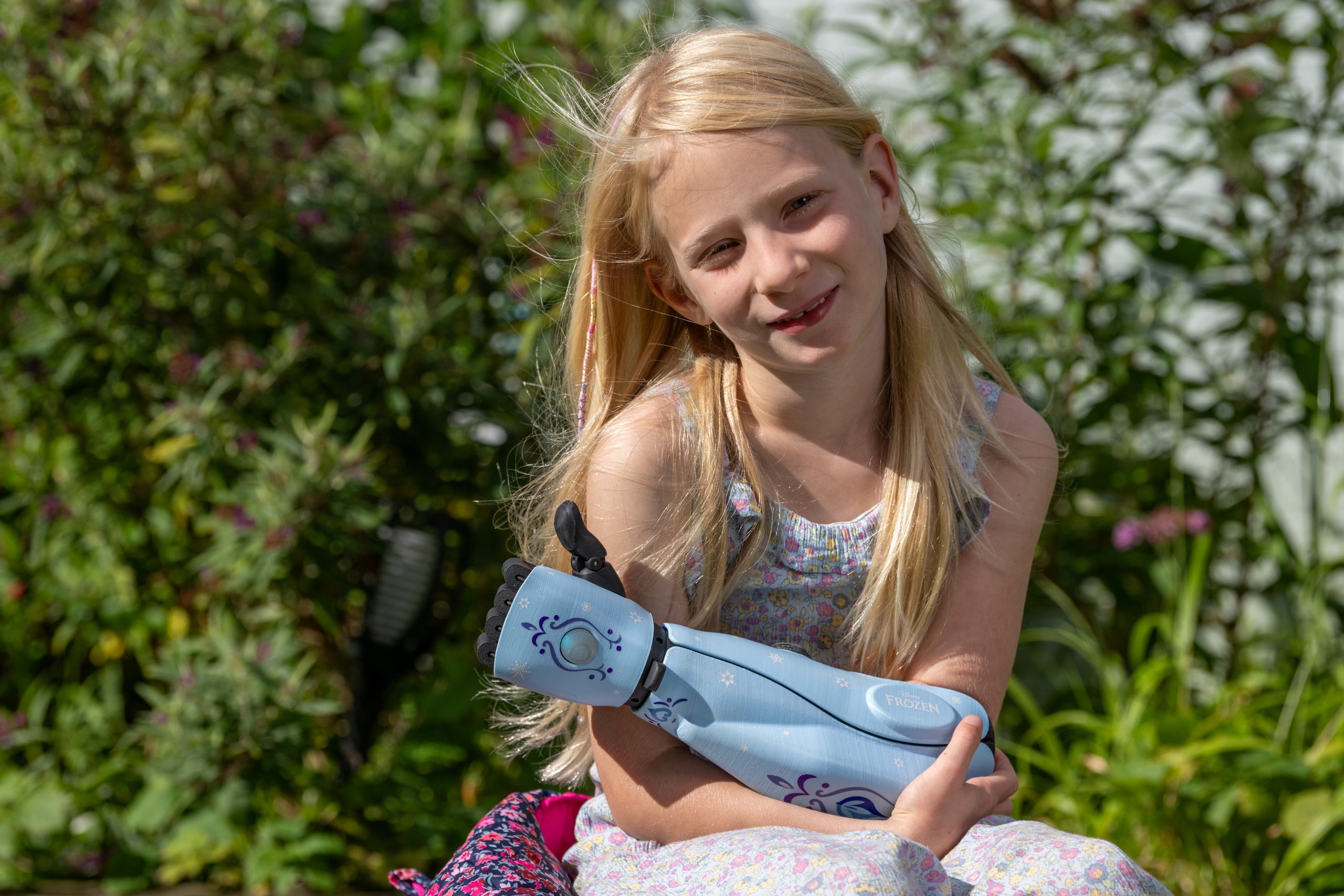 Girl, 7, gets bionic arm
