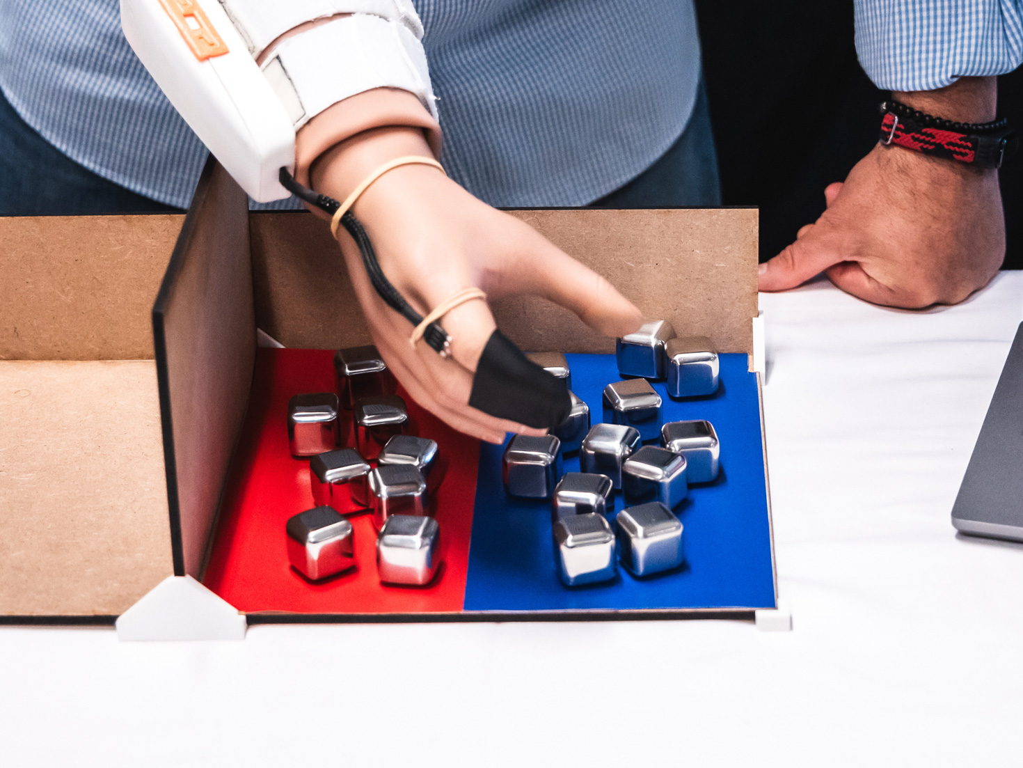 New prosthetic hand first in world to sense temperature